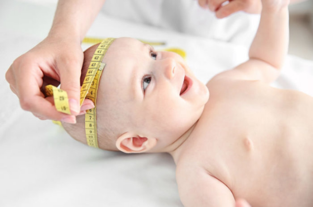 Cranioestenose: deformidade progressiva na cabeça do bebê