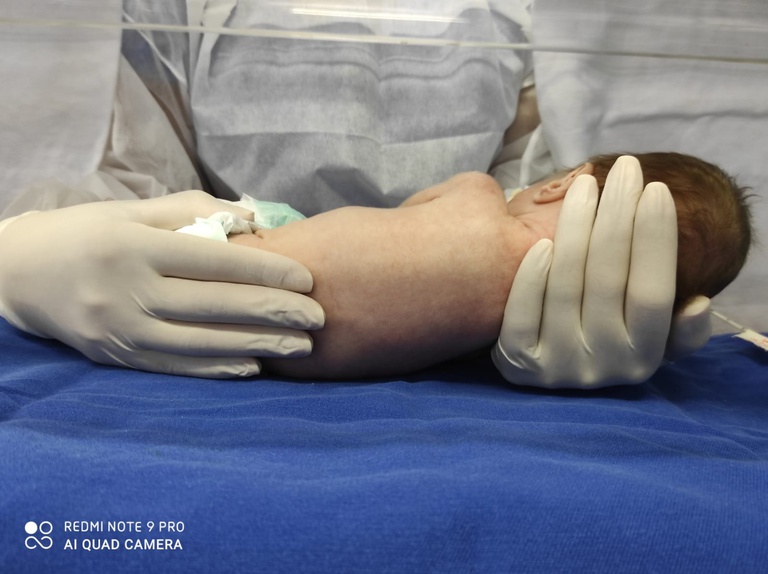 Estudo evidencia benefícios da fisioterapia neonatal em bebês ...
